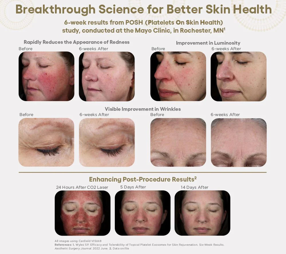 ( plated )™ INTENSE Serum – Clarity Medical Aesthetics